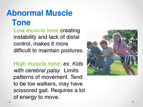 The Role of the Adapted Physical Educator - Part 1 - PaTTAN